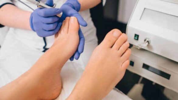 Best Over the Counter Toenail Fungus Treatment - Do They Really Work ...