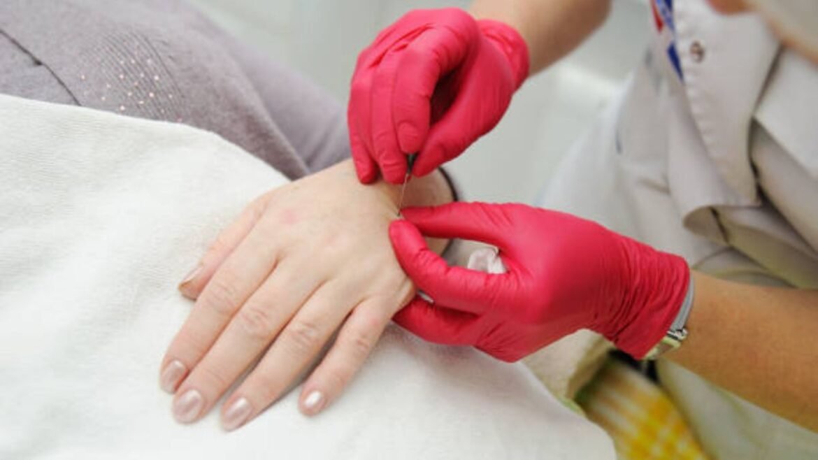 Cutting Edge Varicose Vein Treatment Options You Should Know About ...